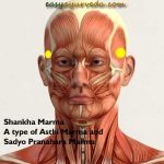 Marmas Of The Head And Neck: Shiro Griva Gata Marmas