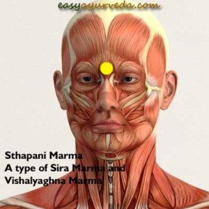 Marmas Of The Head And Neck: Shiro Griva Gata Marmas