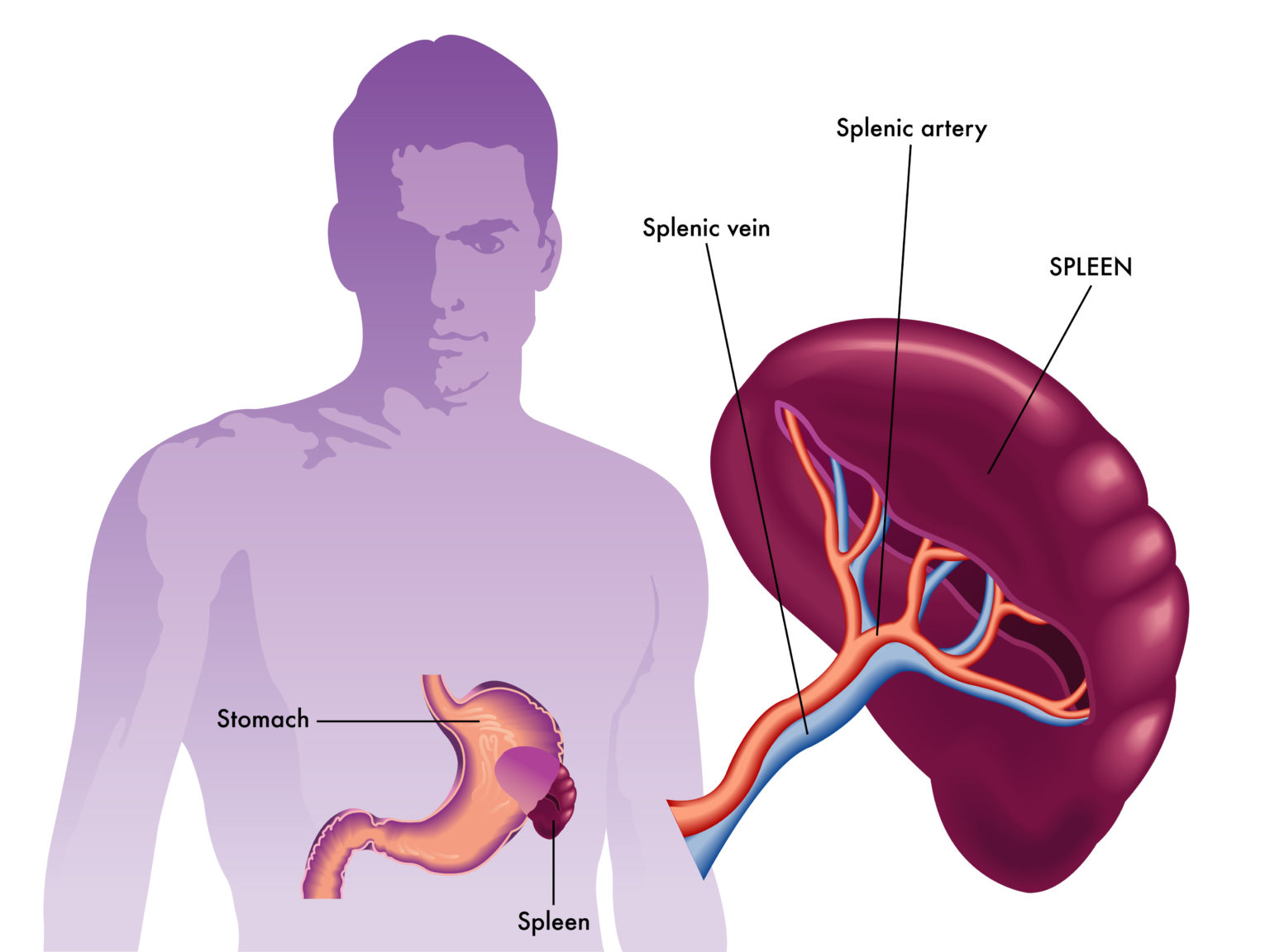Splenomegaly – Ayurveda Concept, Symptoms, Causes, Remedies